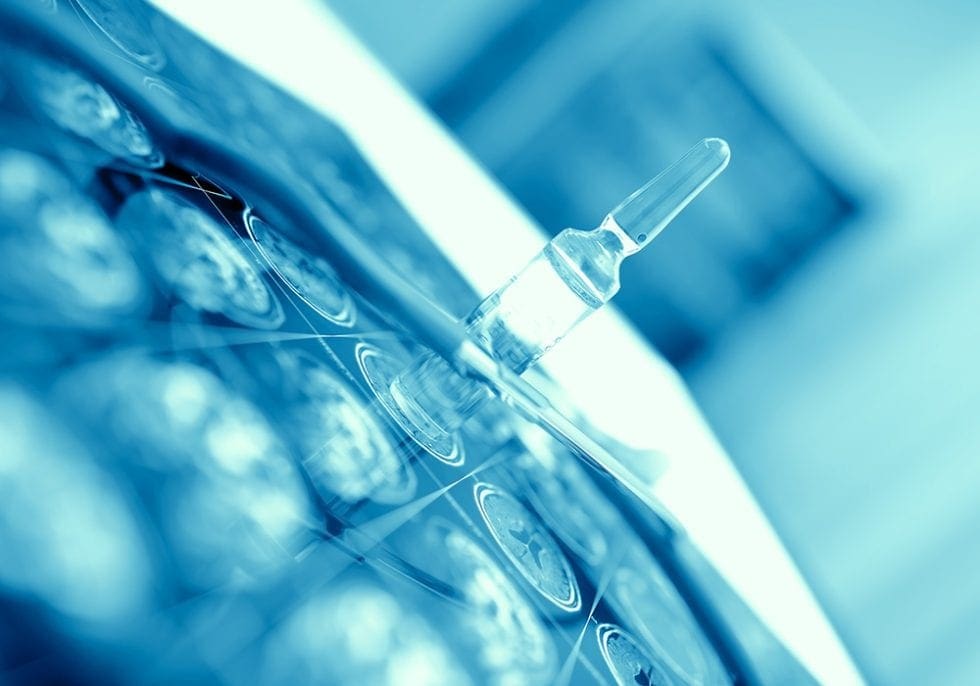 PKAN drug fails Phase III trial: How to avoid a similar disaster ...